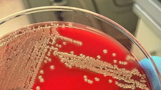 Notificaron 118 casos de Streptococcus Pyogenes en el país y ya son 16 ...